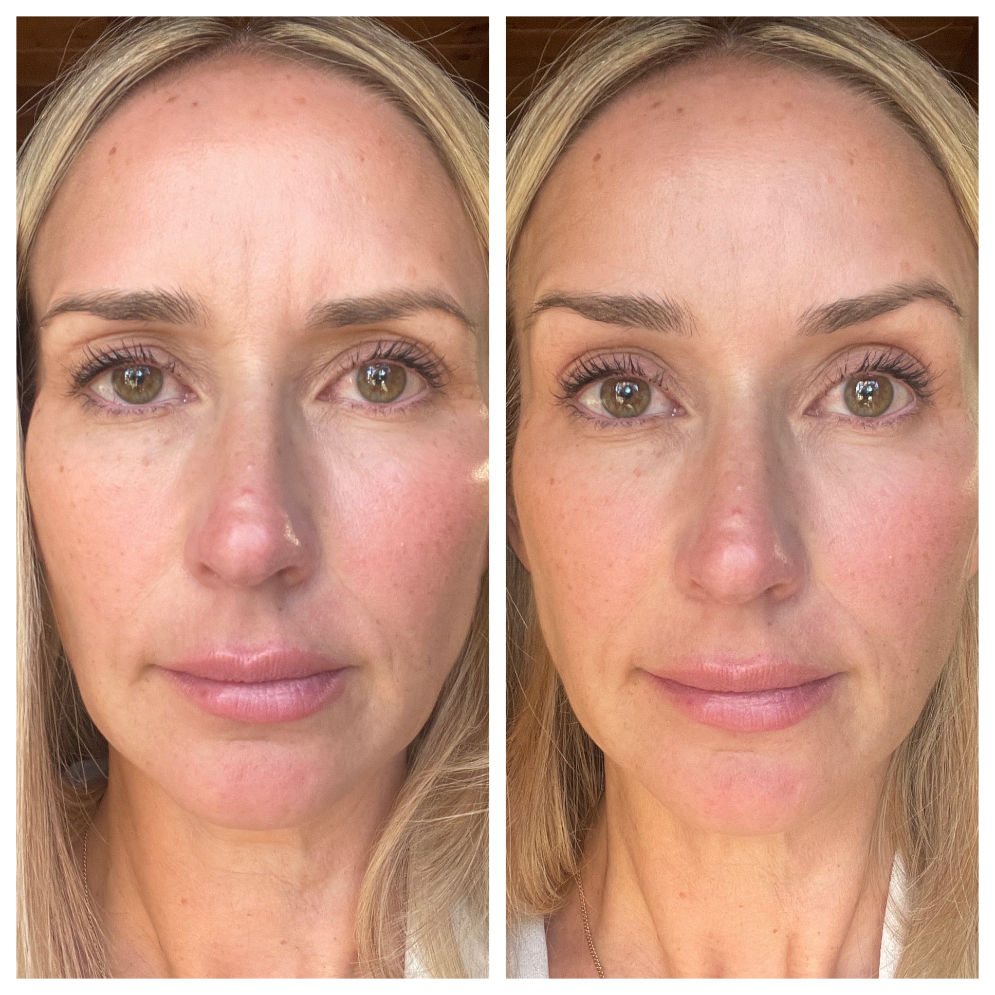 Are Microcurrent Tools Okay for Sensitive Skin? What You Need to Know ...