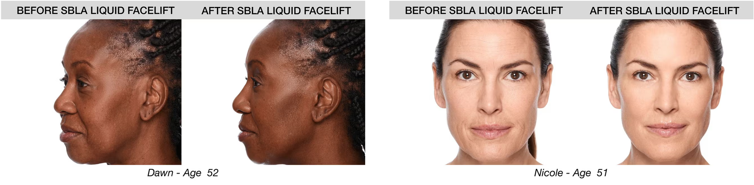 Liquid Facelift Wand - Lifting, Firming & Smoothing Serum | SBLA BEAUTY