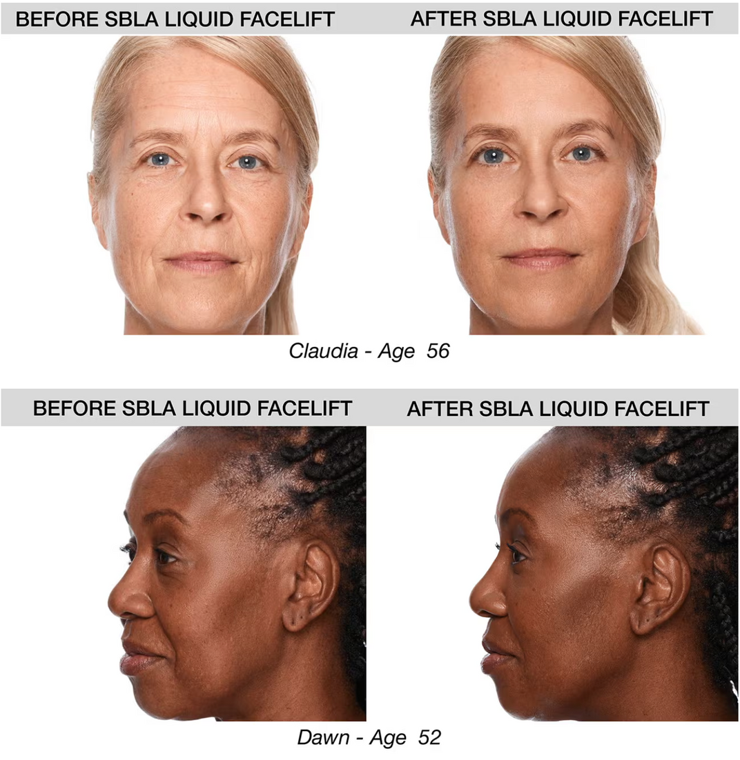Liquid Facelift Wand - Lifting, Firming & Smoothing Serum | SBLA BEAUTY