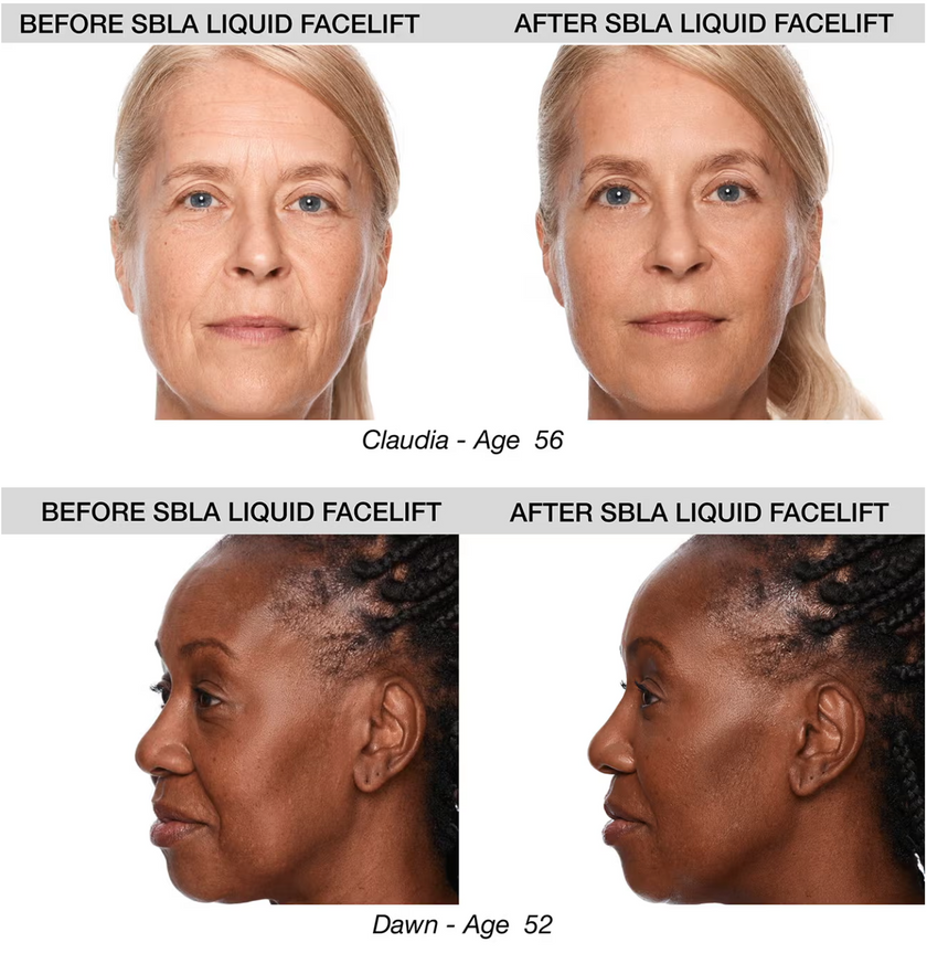 Liquid Facelift Wand - Lifting, Firming & Smoothing Serum | SBLA BEAUTY