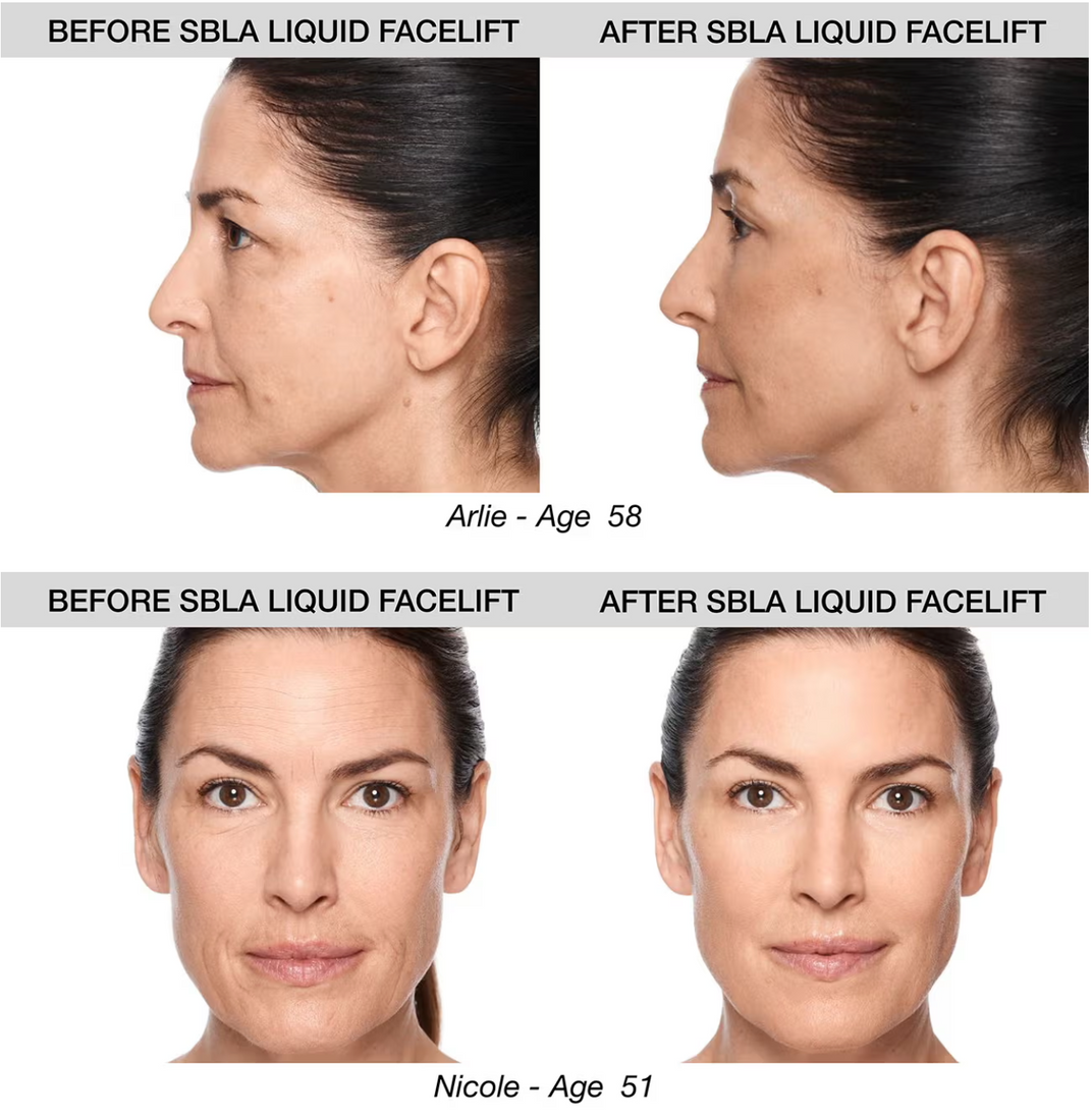 Liquid Facelift Wand - Lifting, Firming & Smoothing Serum | SBLA BEAUTY